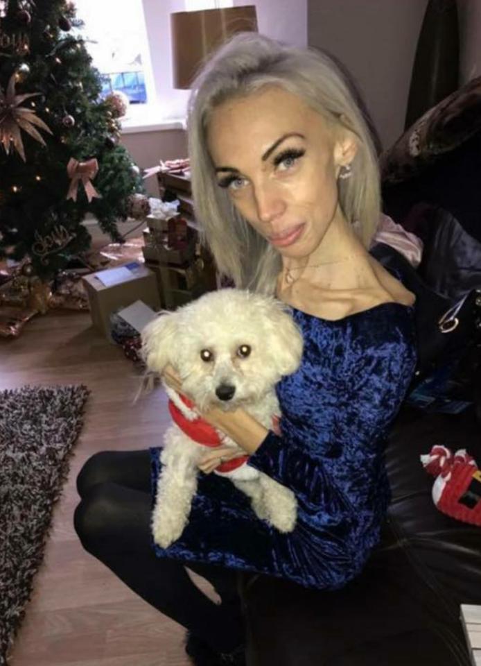 Hannah Lucas: ''Come ho sconfitto l'anoressia e come sono diventata ...