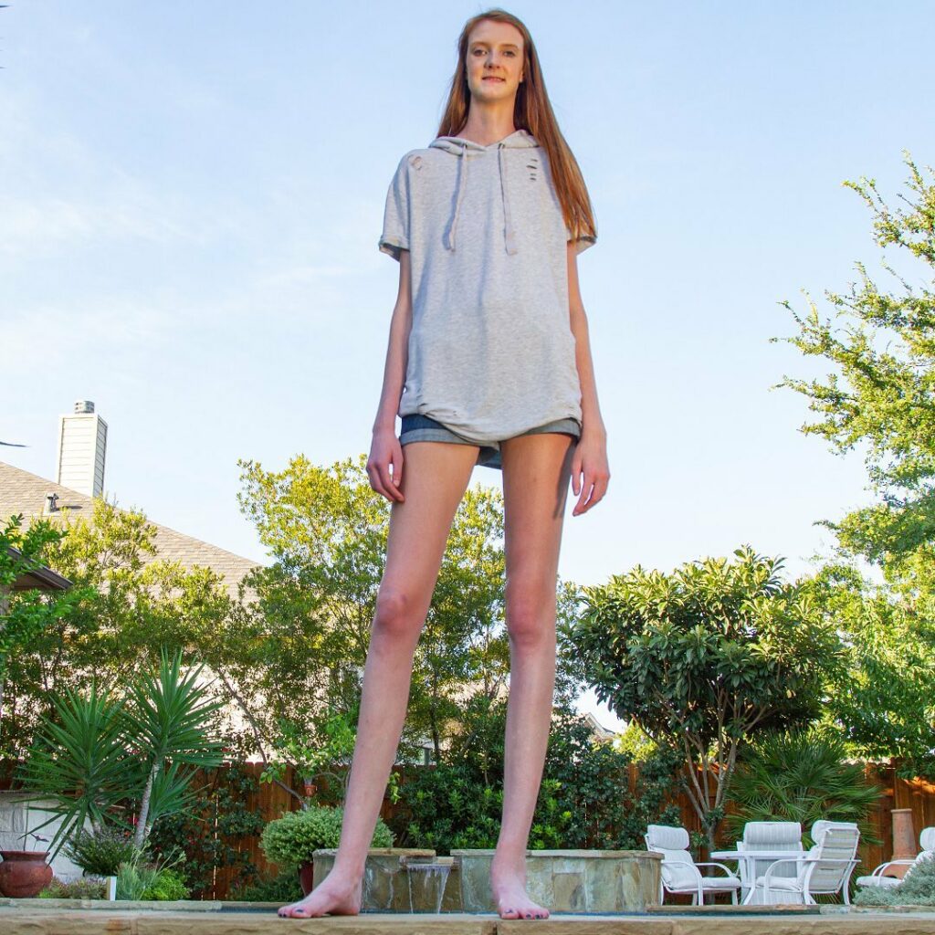 Maci Currin, 17 anni e le gambe più lunghe del mondo: misurano 135 cm