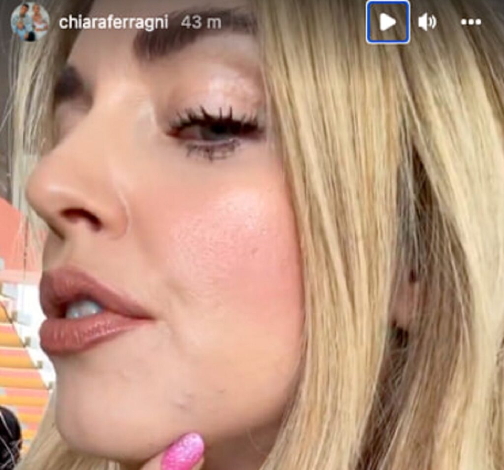 Chiara Ferragni, la foto dello sfogo da stress sul viso: "Guardate..."