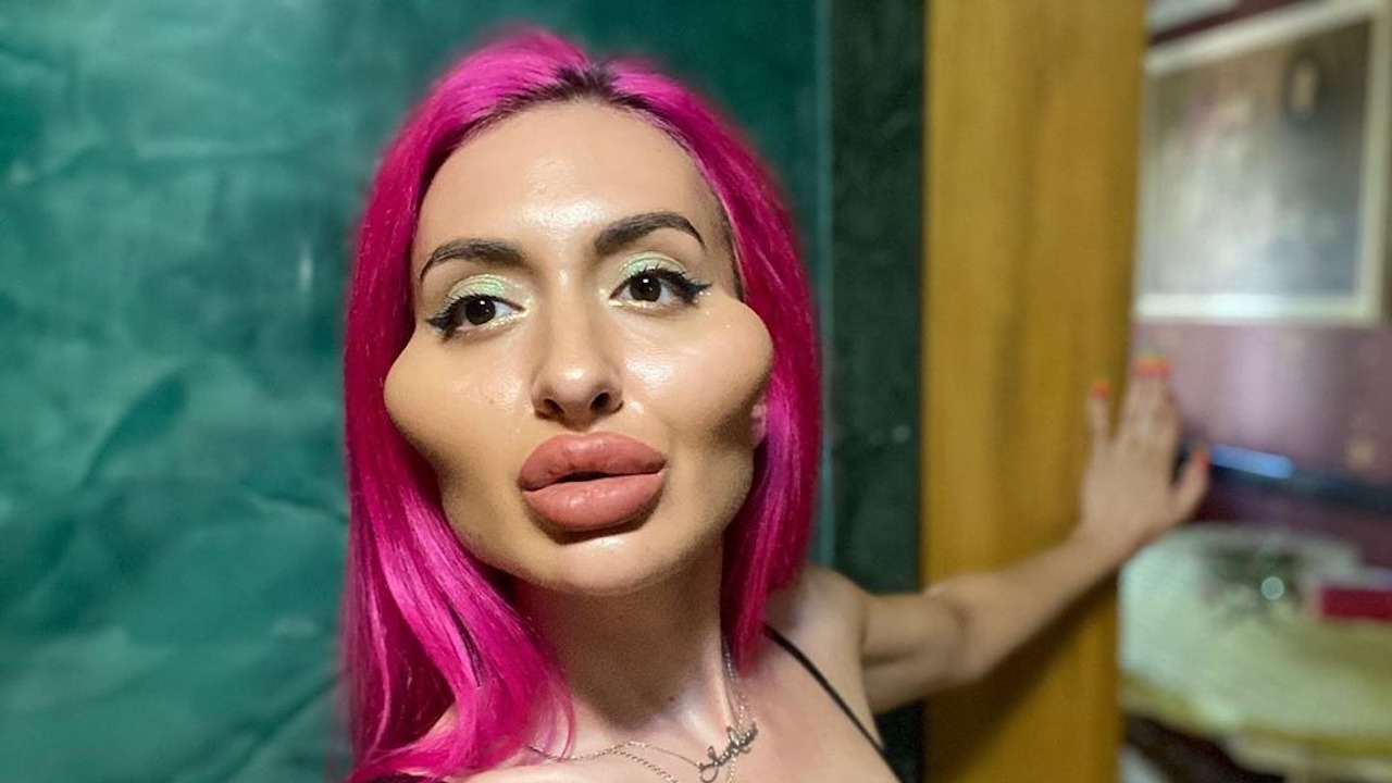 Anastasia Pokreshchuk, modella con gli zigomi enormi: come era